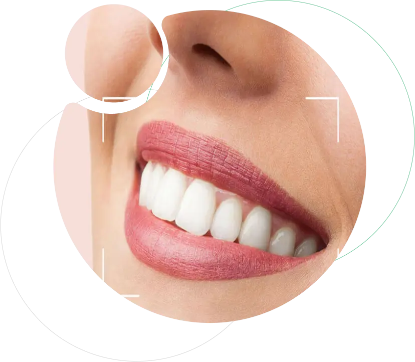 Digital Smile Design in Nanganallur | Digital Smile Design in Chennai